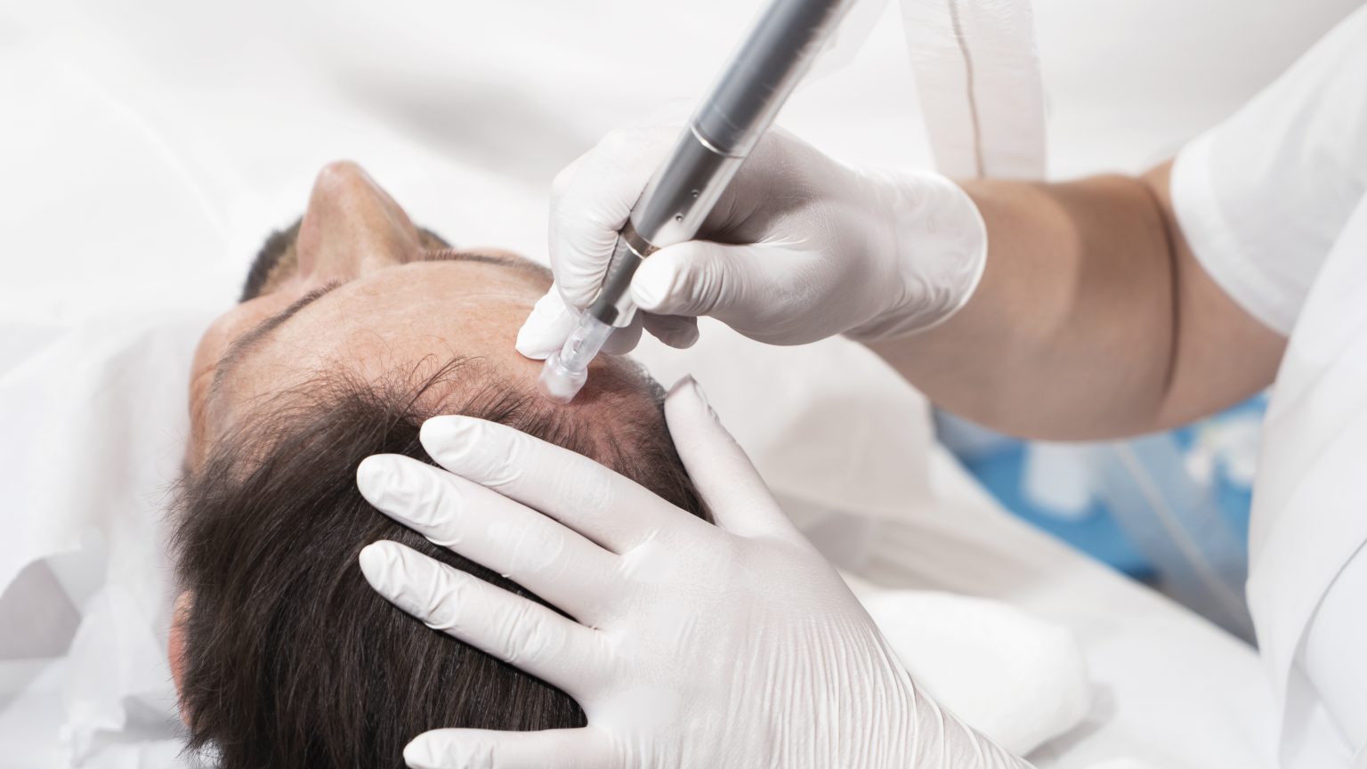 Procedimiento Dermaneedling - Paola Gateno Studio